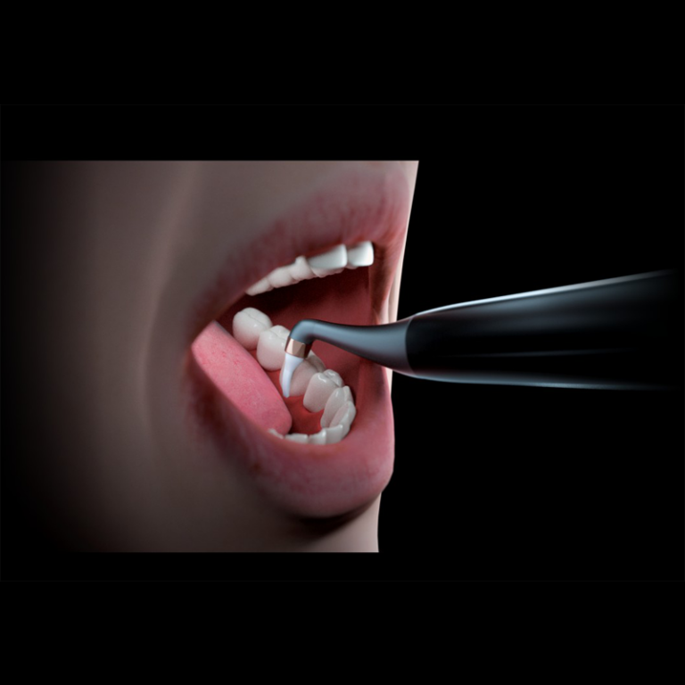 Woodpecker AP-H Plus Prophy & Perio Air Polisher | Dental Air Polishing